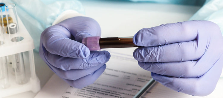 Hormone Levels & Fertility Bloodwork – Fairhaven Health